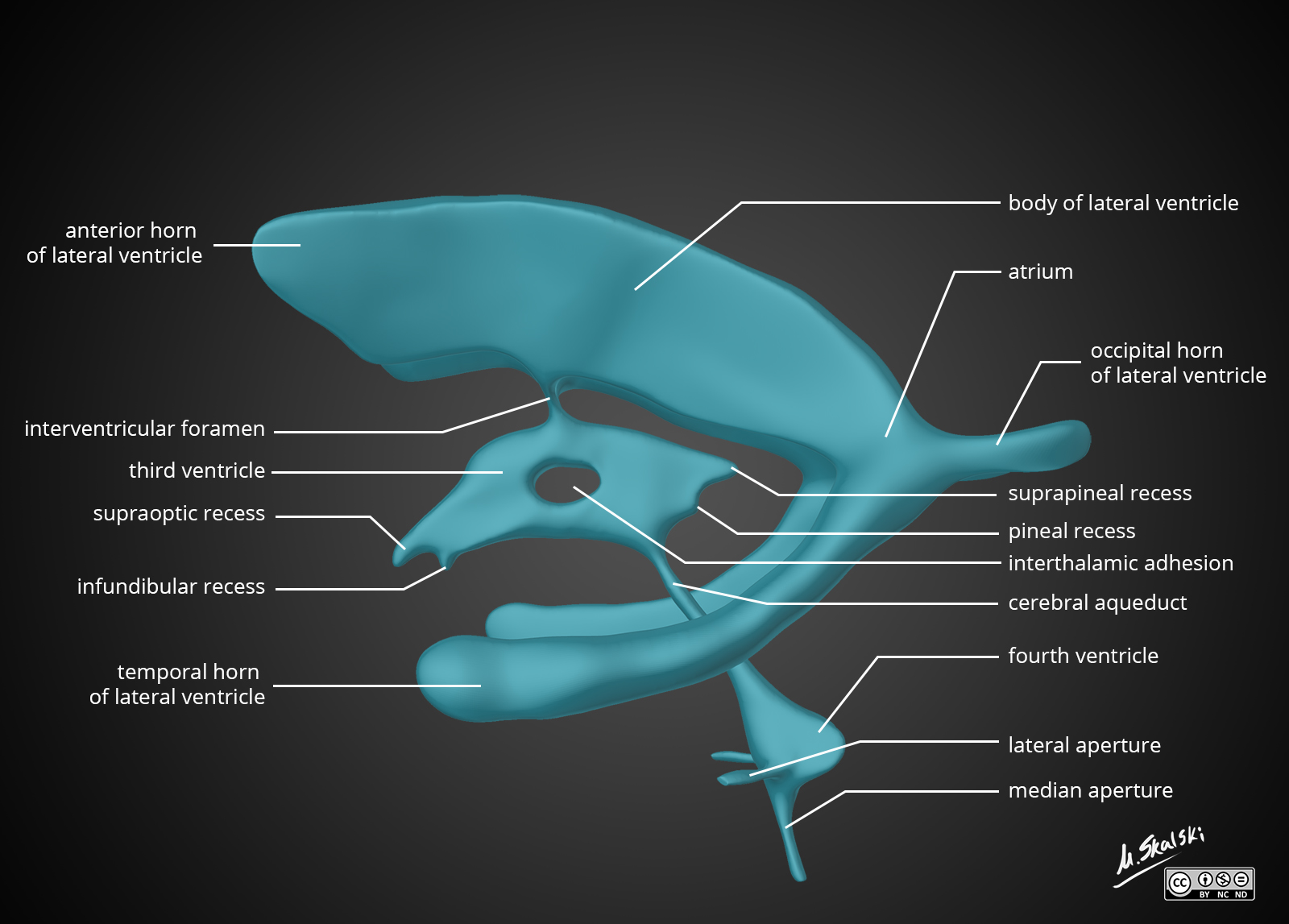 Radiopaedia - Drawing Anatomy of the brain ventricles - English labels | AnatomyTOOL
